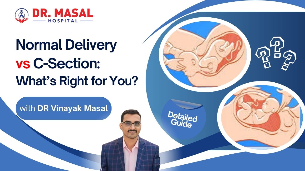 Normal Delivery vs C-Section – Guide by Dr Vinayak Masal